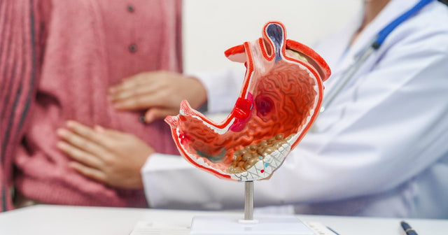 Esophageal Ulcers: What They Are and When to Worry – Advanced Food ...