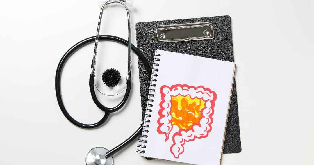 What is Pancolitis: Understanding the Causes and Symptoms – Advanced ...